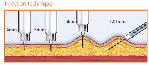 Tiêm insulin ở người bệnh đái tháo đường: Những điều cần biết