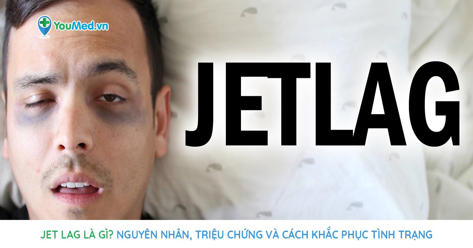 Jet lag là gì? Nguyên nhân, triệu chứng, cách khắc phục - YouMed