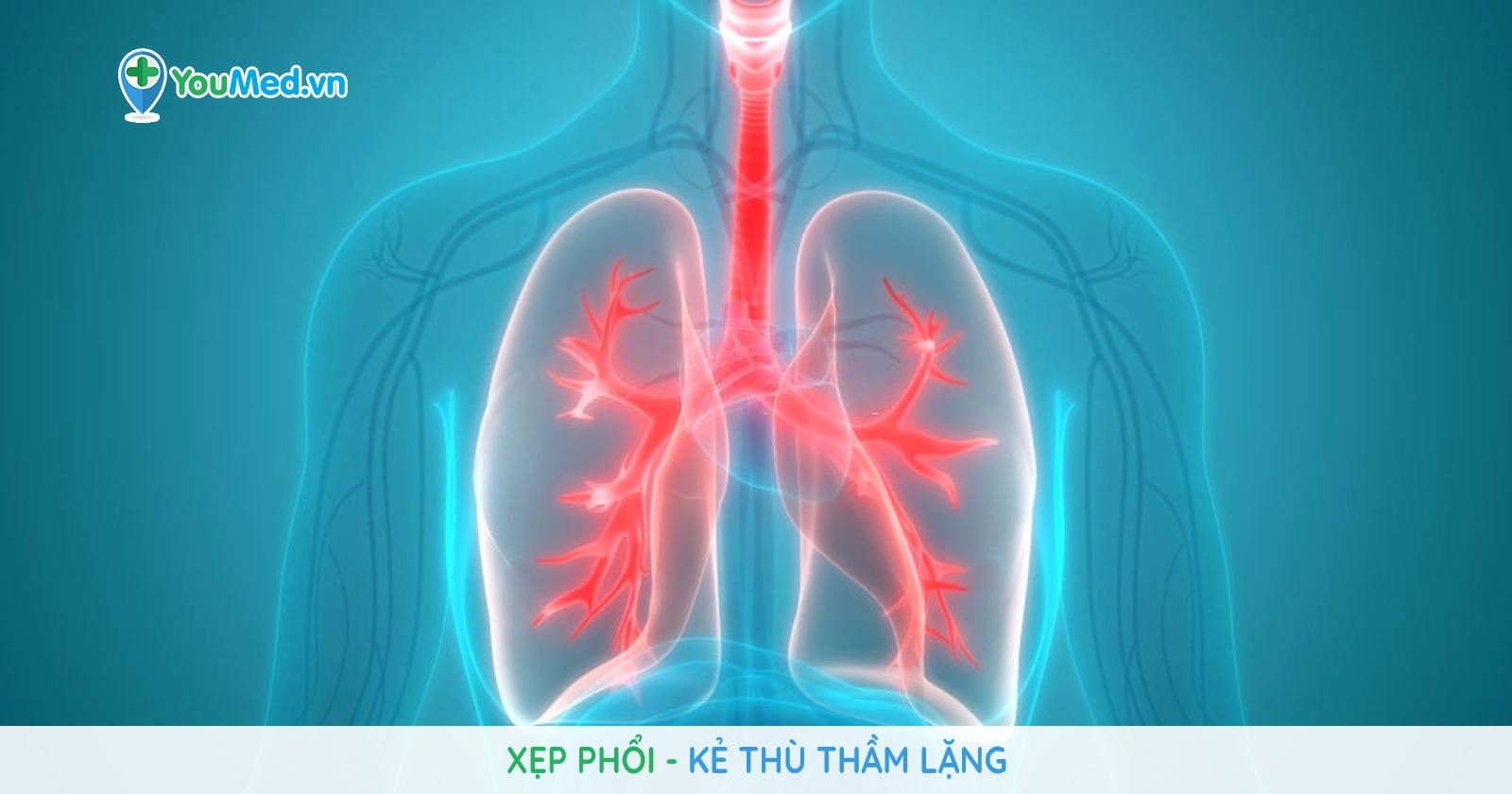 Xẹp phổi: nguyên nhân, triệu chứng và cách điều trị - YouMed