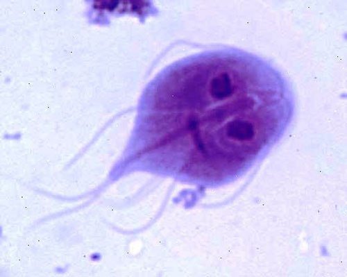 Trùng roi kí sinh ở ruột: Nhiễm Giardia Lamblia - YouMed