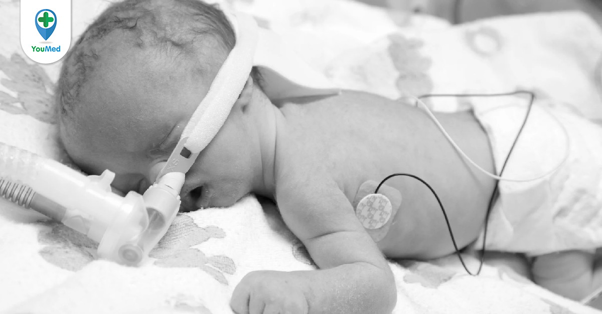 Hội chứng Patau (Trisomy 13): Nguyên nhân, triệu chứng và cách điều trị ...